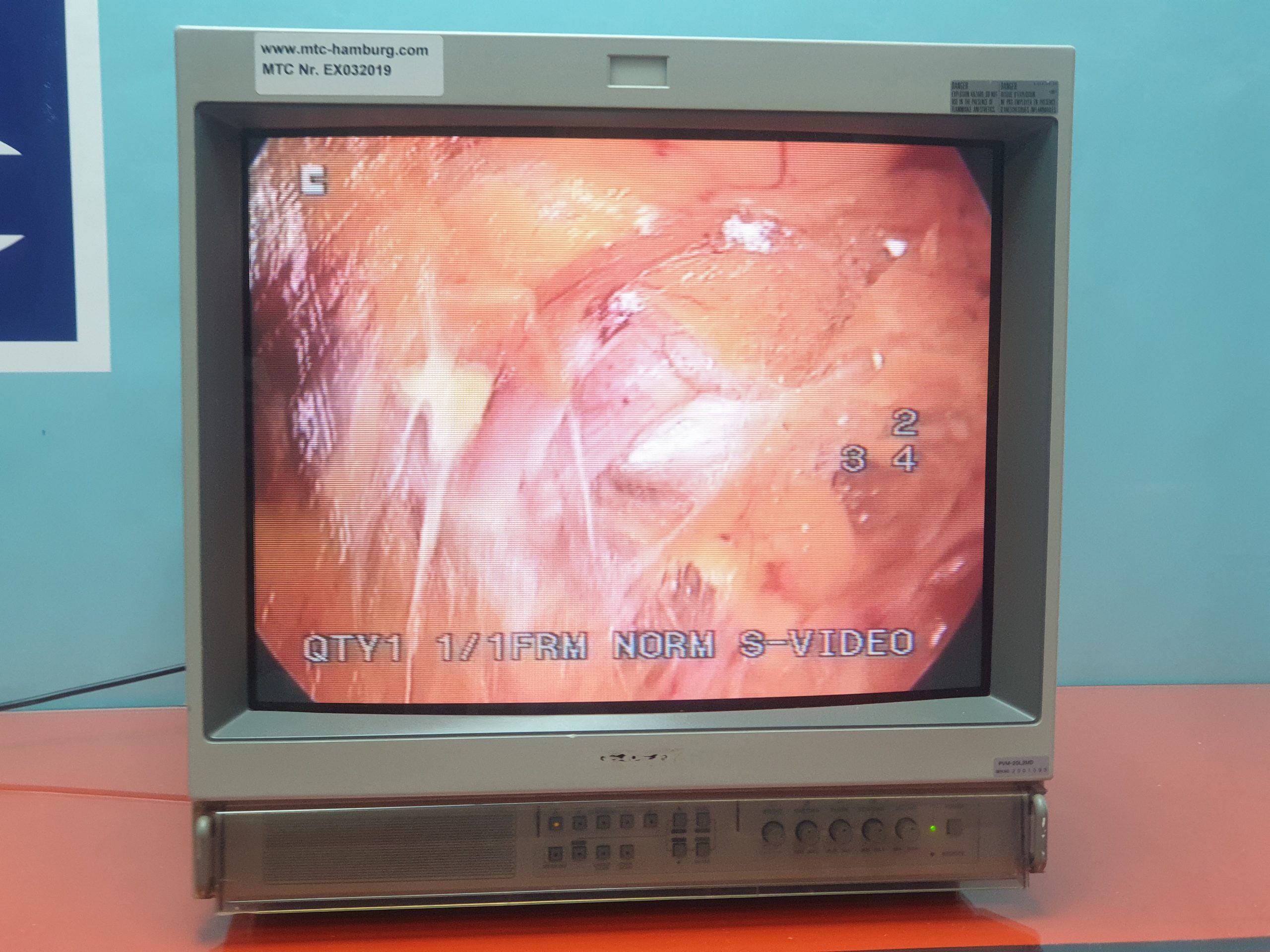 Sony PVM-20L2MD Monitor – MTC Hamburg - Gebrauchte Medizintechnik