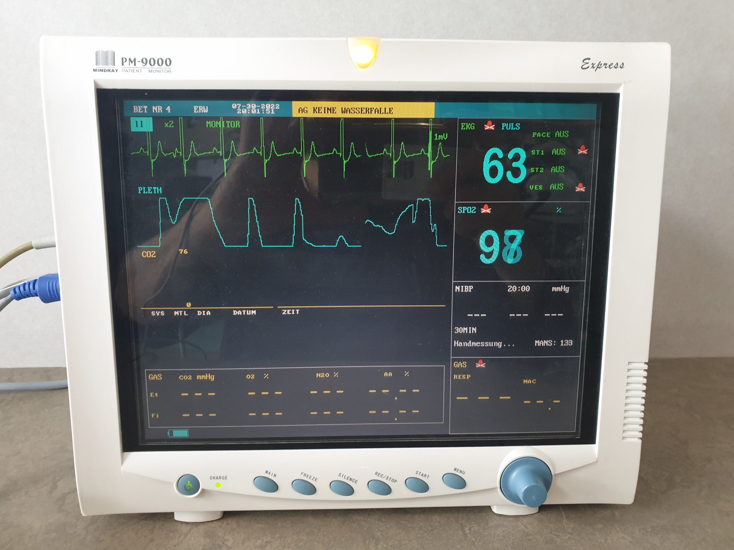 Mindray PM-9000 Express Patientenmonitor mit Zubehör – MTC Hamburg ...