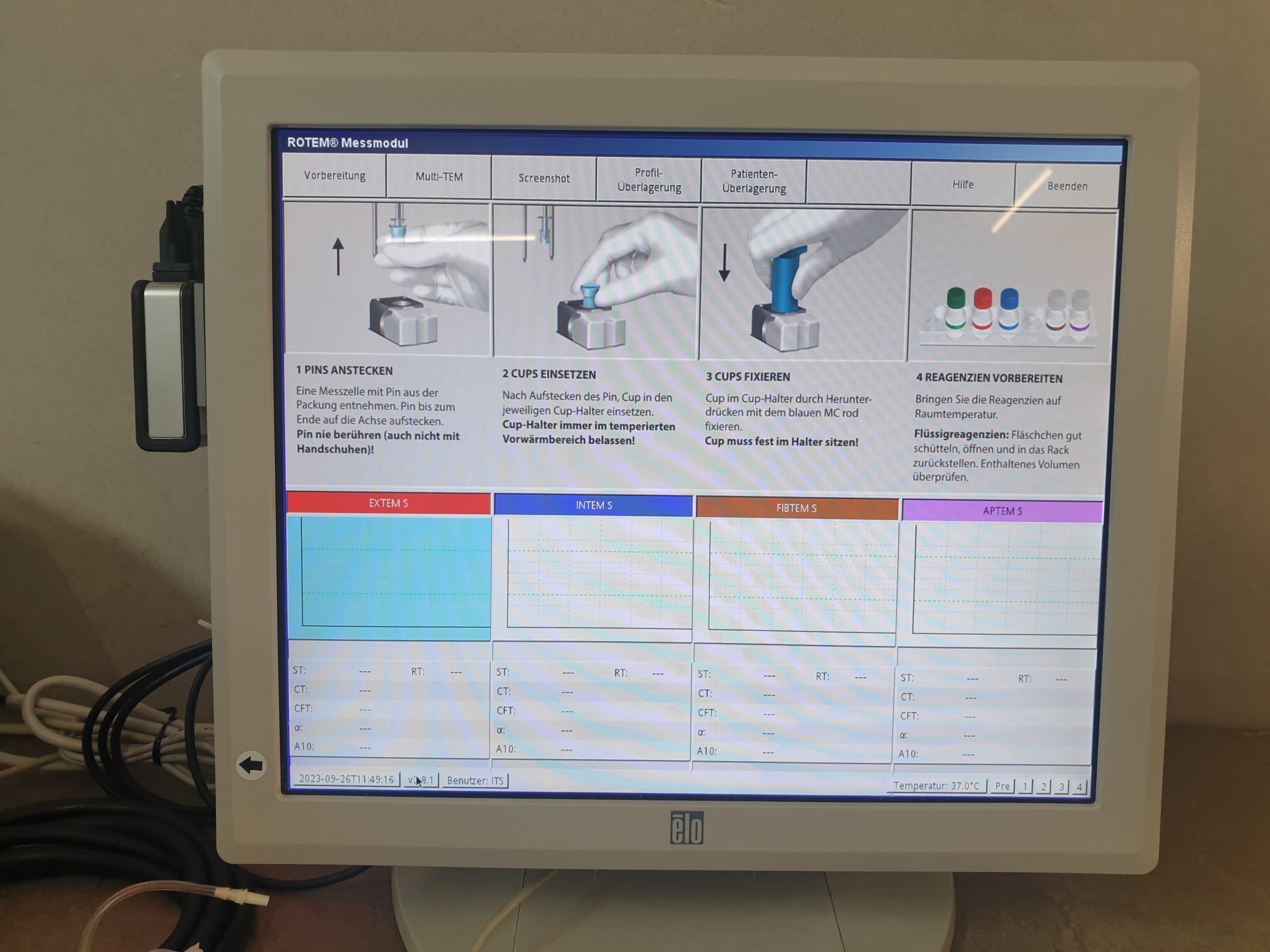 Rotem Delta Blutungsmanagement Thromboelastographiegerät Werfen – MTC ...